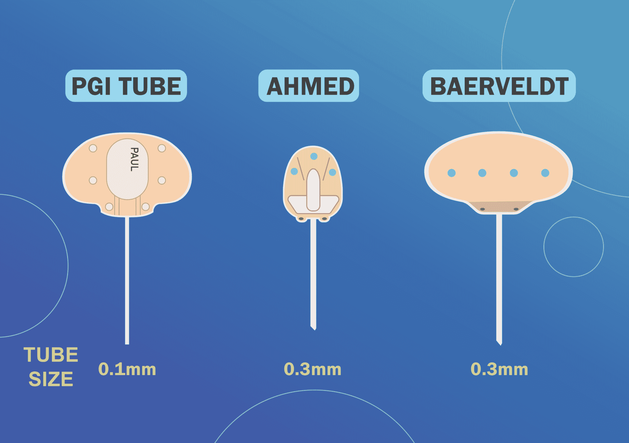 Dr. Chelvin Sng: Why Paul Glaucoma Implant is changing the future of ...